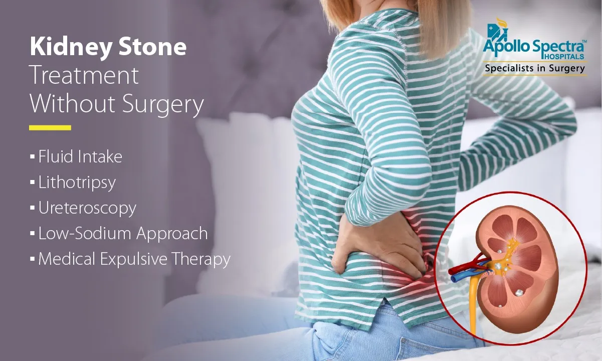 Kidney Stone Treatment Without Surgery Apollo Spectra